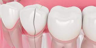 Emergency Dentistry Guide: Quick Tips for Dental Emergencies